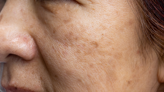 Pulsed LED Light Therapy | How It Works – Maysama