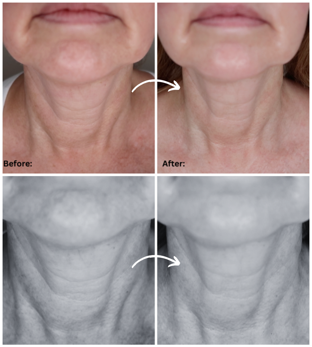 Before and Afters – Maysama